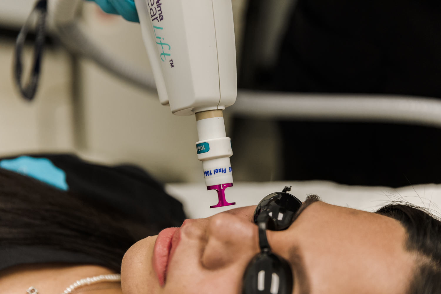 Clearlift Laser Facial Sherwood Park - The Laser Room of Sherwood Park